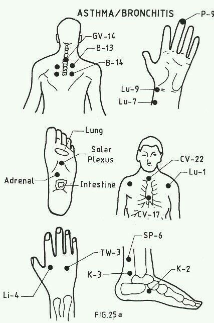 Asthma Acupression Asthme Medecine Chinoise