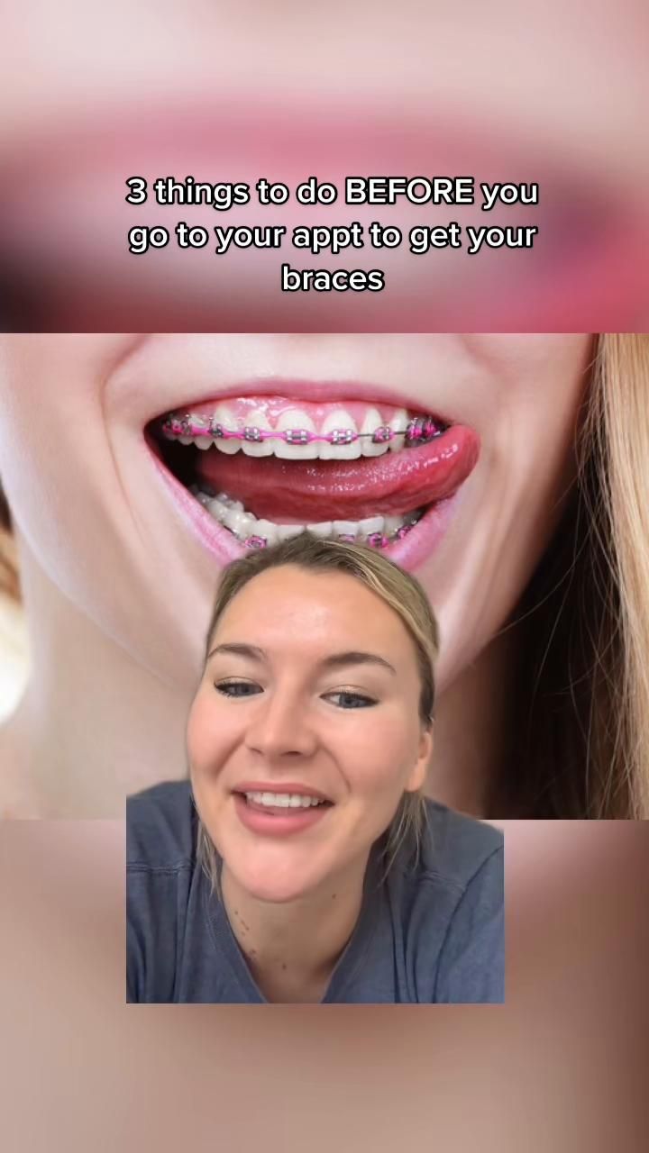 42 Braces Teeth Colors Ideas In 2024 Braces Teeth Colors Braces Braces Tips