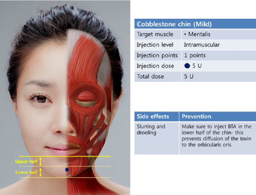 Figure 14 From Consensus Recommendations On The Aesthetic Usage Of