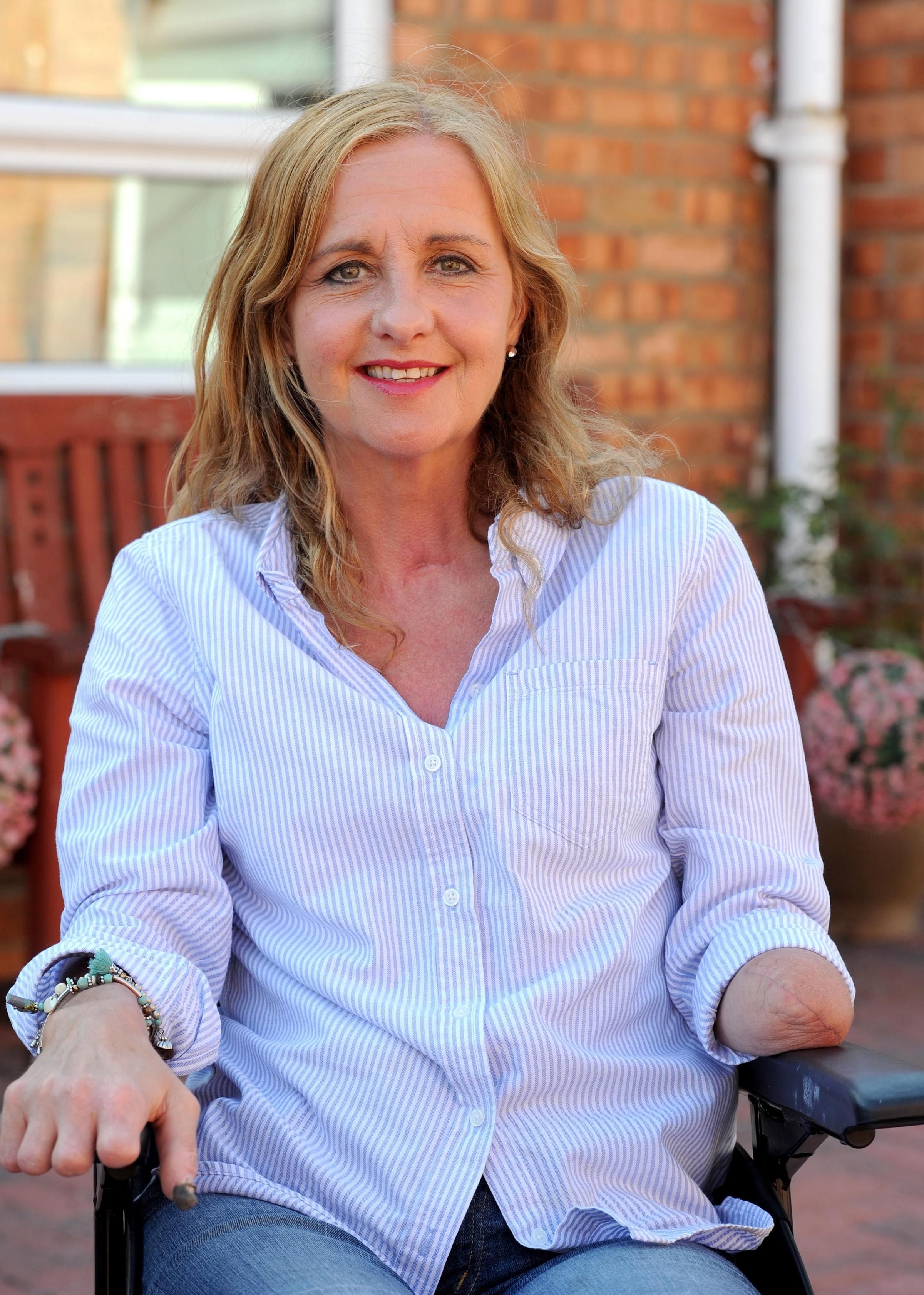 A Royal Gwent Hospital Nurse Who Lost Both Legs An Arm And Four