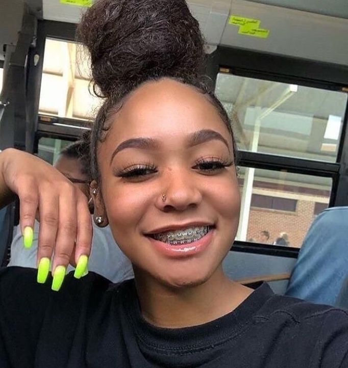 Cute Braces Colors Braces Girls Cute Hairstyles Braided Hairstyles