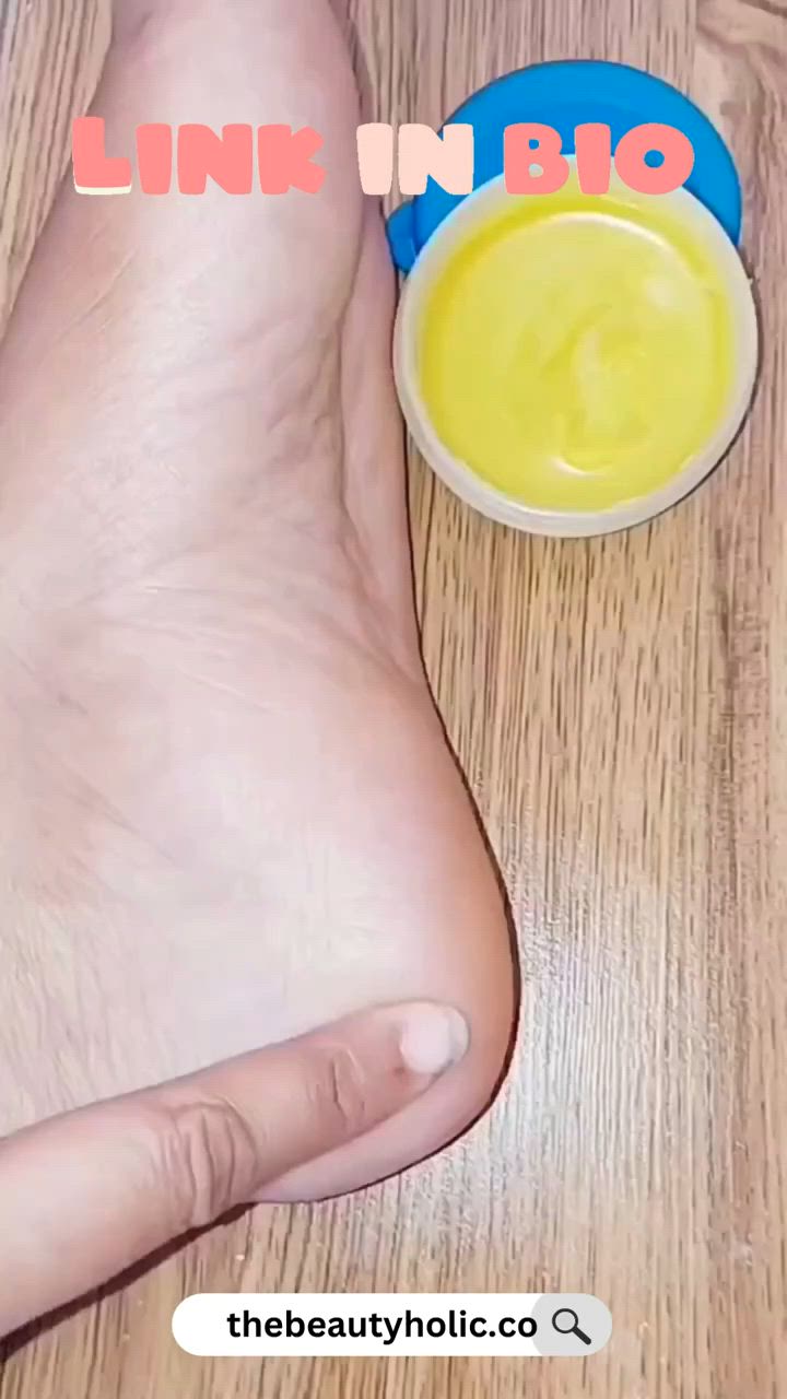 Mysha Beauty Queen Influencer On Instagram 😇homemade Cracked Heel